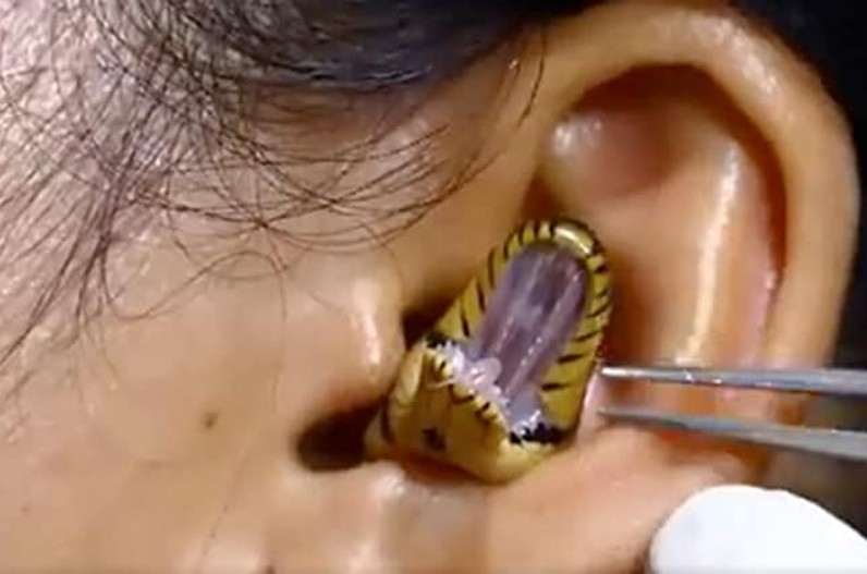 Edited By : Shyam Dwivedi November 29, 2022 / 08:47 PM IST